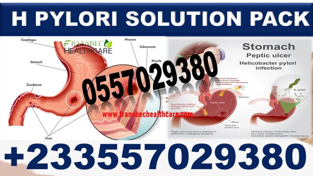 Best Solution for H Pylori Bacteria in Ghana - 0557029380